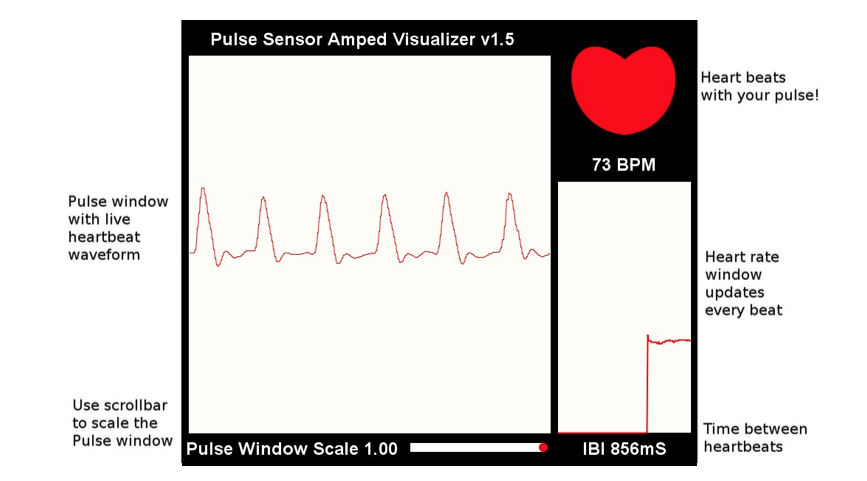 How to Track Your Heartbeat with Raspberry Pi and Arduino | Raspberry ...