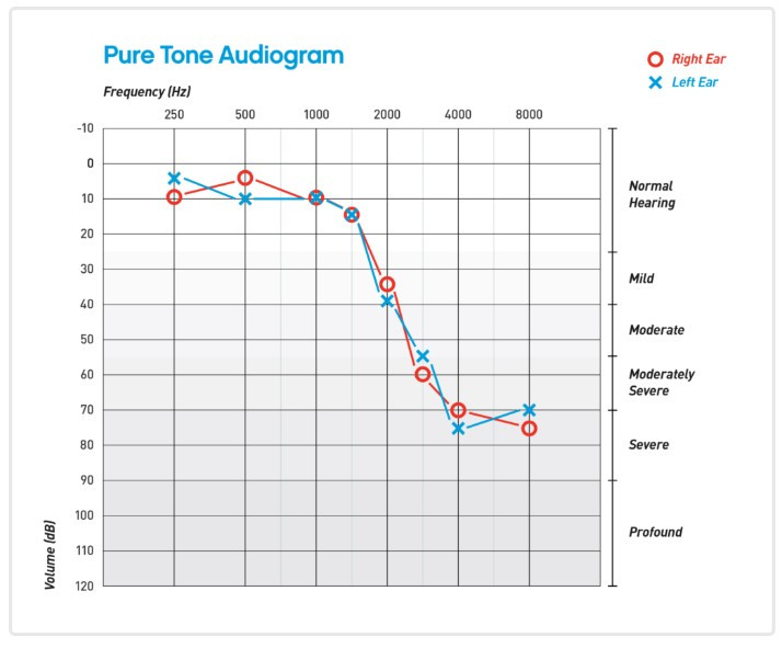 Arduino hearing test device - Audiometer | Arduino | Maker Pro