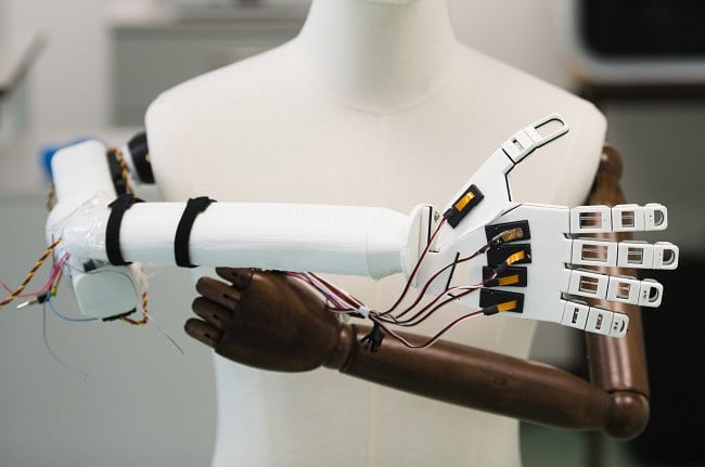 Utilising 3D-Printed and Wireless Communication-Based Prosthetics ...
